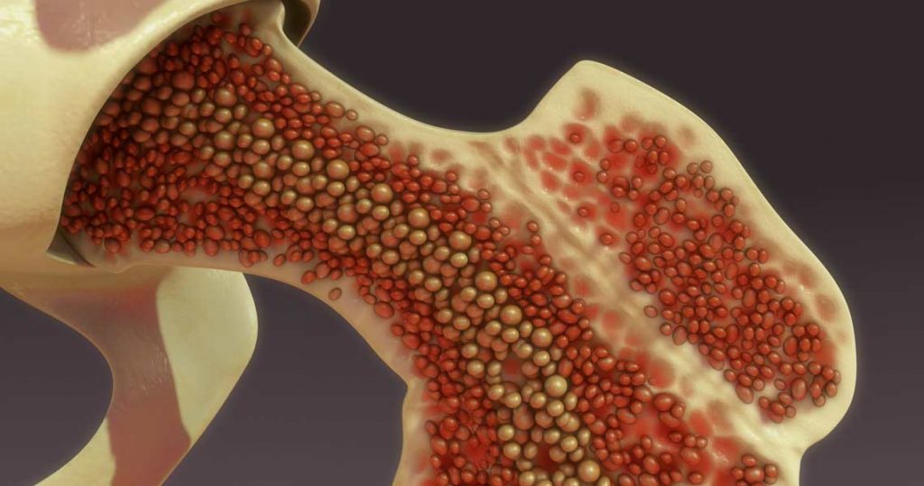 bone-marrow-3d-illustration | Association Canadienne De L'anémie ...